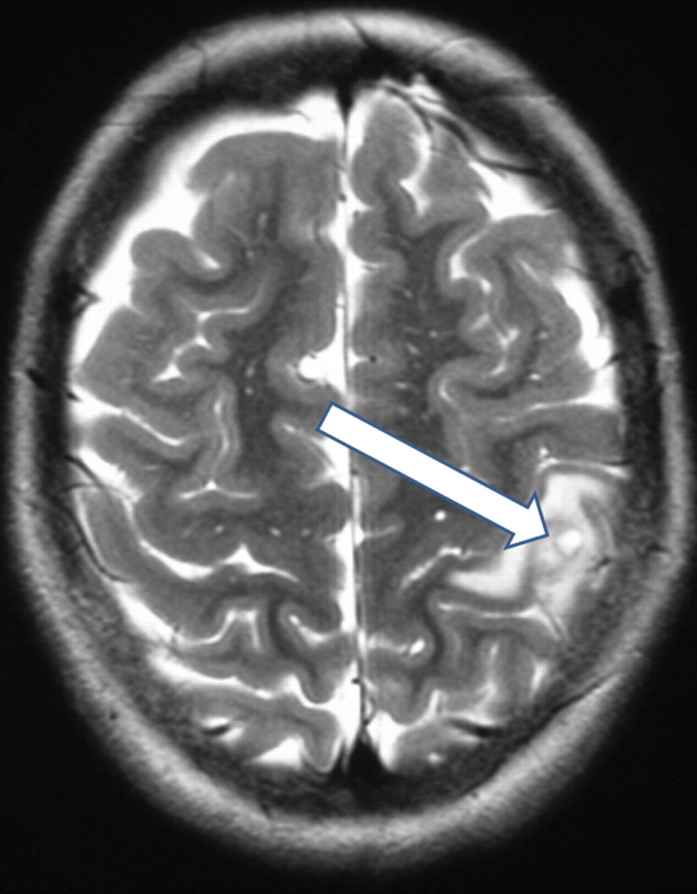 Neurogastroentrology: an A to Z | Practical Neurology