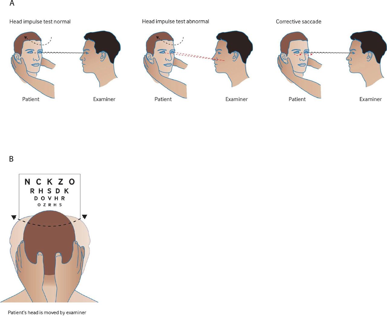 Neurological gait assessment | Practical Neurology