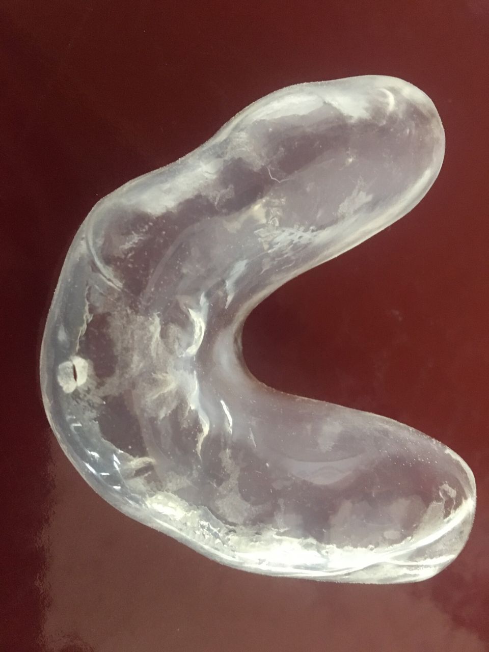 Lip and tongue biting in patients with a brain injury: a practical ...