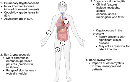 Reframing the clinical phenotype and management of cryptococcal ...