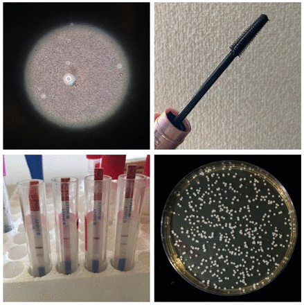 Reframing the clinical phenotype and management of cryptococcal ...